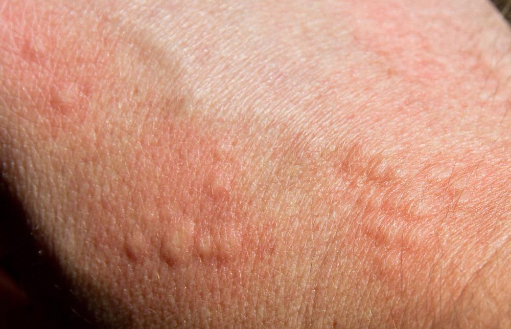 What is Dubonnet? (with pictures)